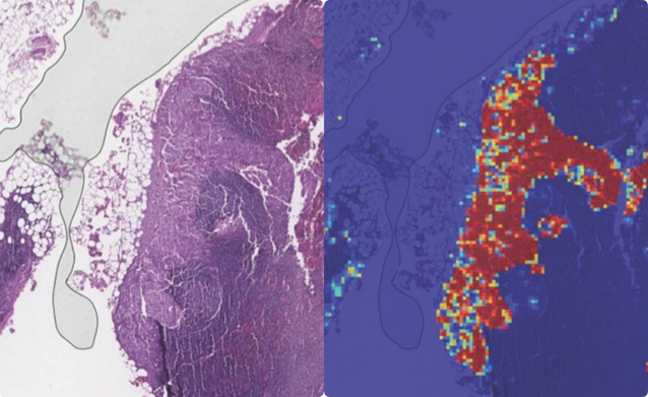 Hệ thống AI LYNA của Google vượt qua con người trong bài thử nghiệm ...